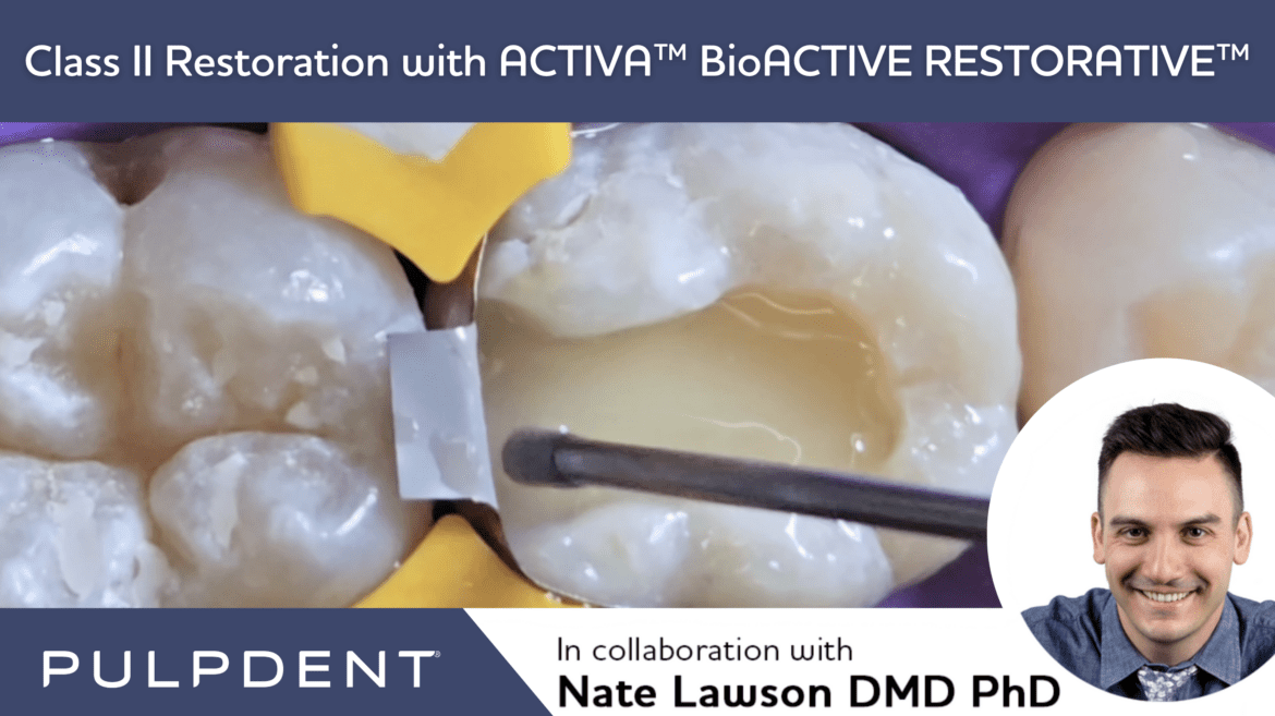 Class II Restoration with ACTIVA™ BioACTIVE-RESTORATIVE™ - PULPDENT